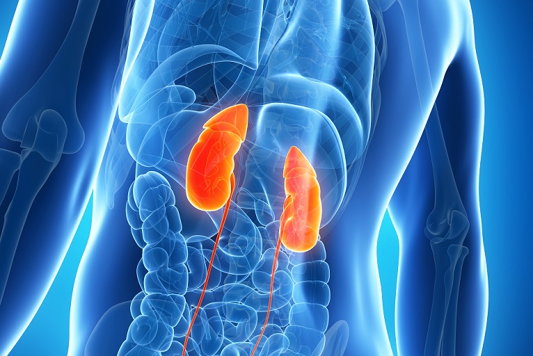 Web tool could aid in early detection of kidney disease - Renal ...