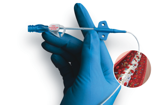Novel peripherally-inserted catheter found superior to conventional options