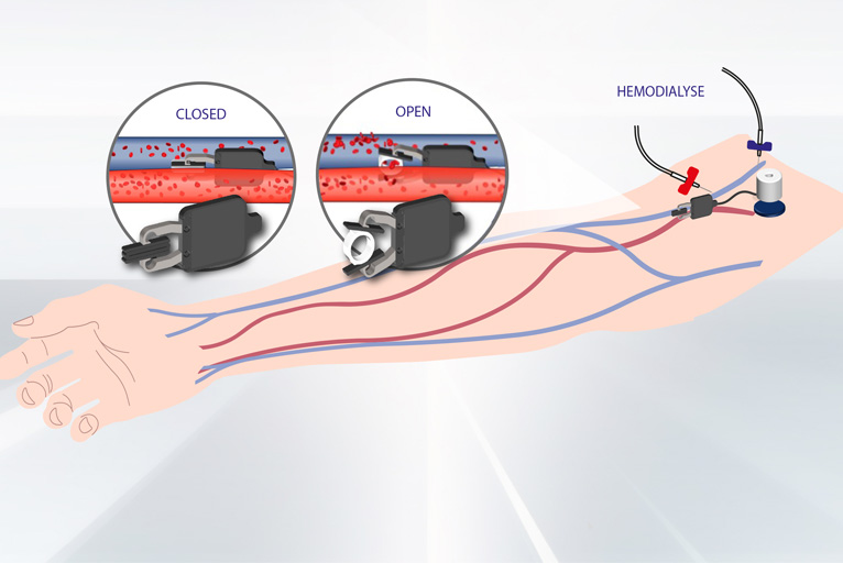 XS Innovations raises seed investment of EUR 1.1 million to accelerate ...