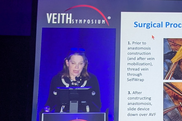 Novel bioabsorbable perivascular wrap aims to reduce AVF failure - Renal Interventions